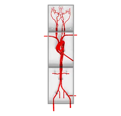 Intracranial Vascular Simulation Models Manufacturer, Circle of Willis ...