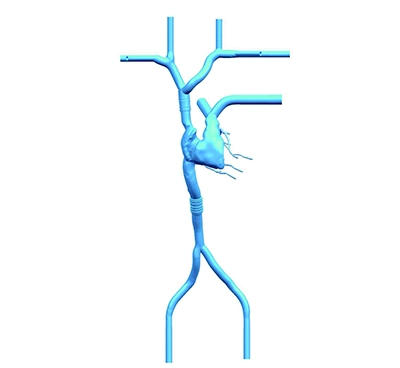 Cardiac Veins Simulation Model (Pacemaker Electrode Implantation ...