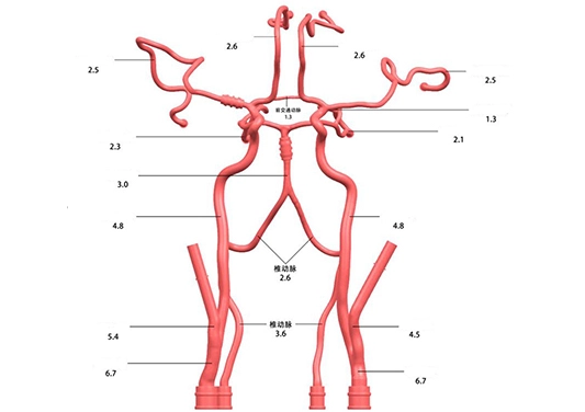 Intracranial Vascular Simulation Models Manufacturer, Circle of Willis ...